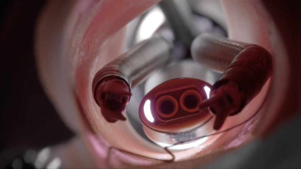 Victoria Hospitals Foundation Launches $21M Campaign for Surgical Robots